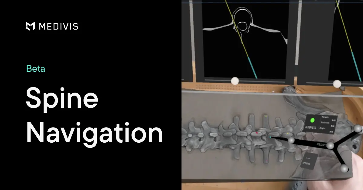 Imagine spine surgeries with greater accuracy and precision.